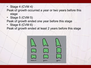 Skeletal maturity indicators | PPT