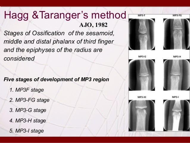 Skeletal maturity indicators