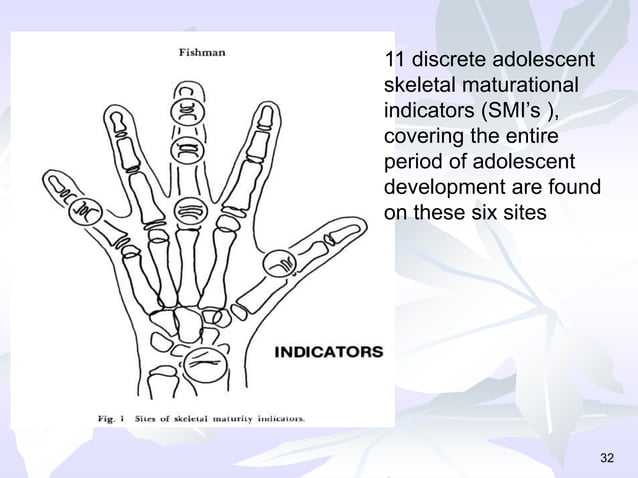Skeletal maturity.ppt | Menopause | Endocrine and Metabolic Diseases