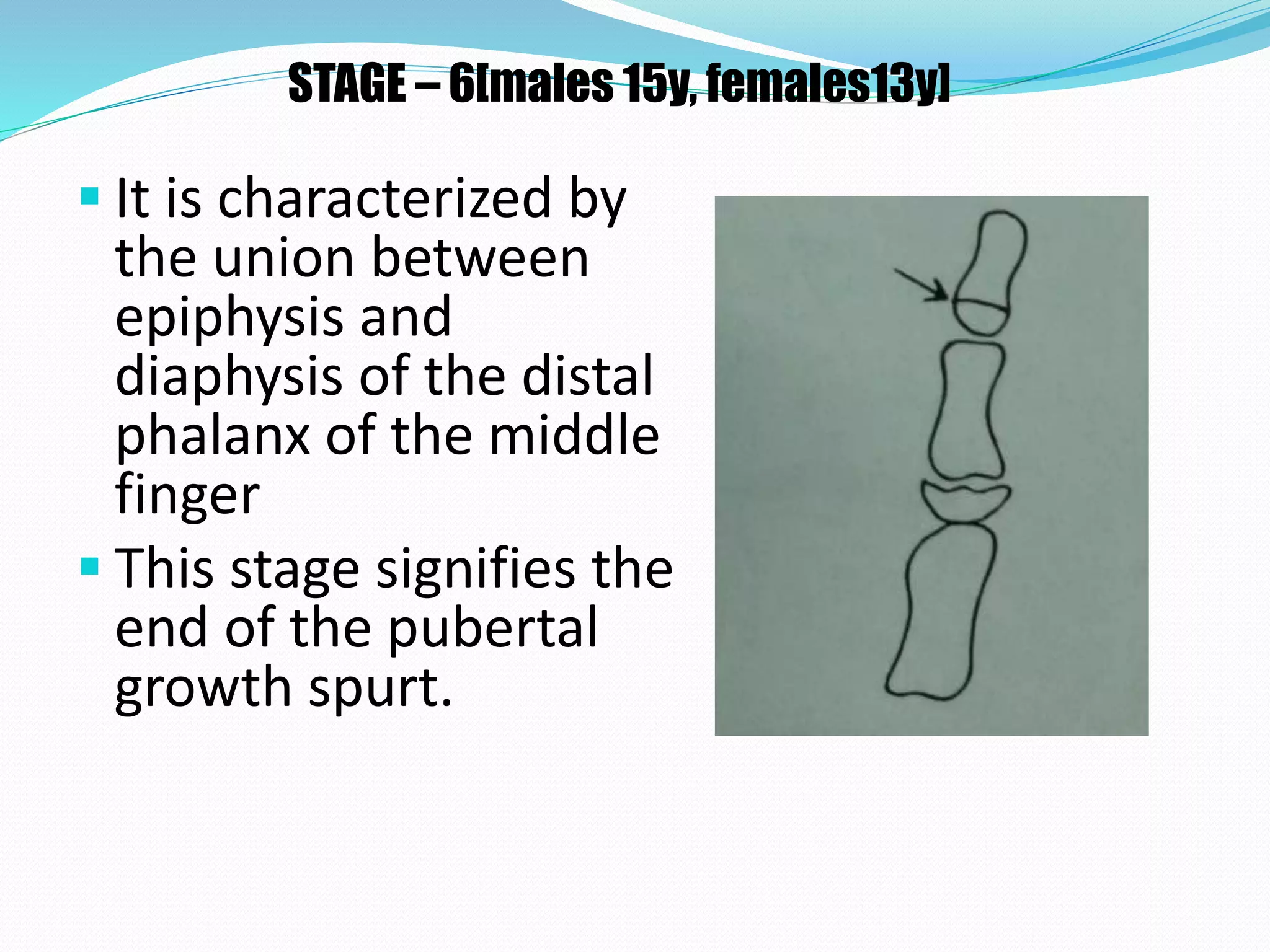 Skeletal maturity index | PPTX