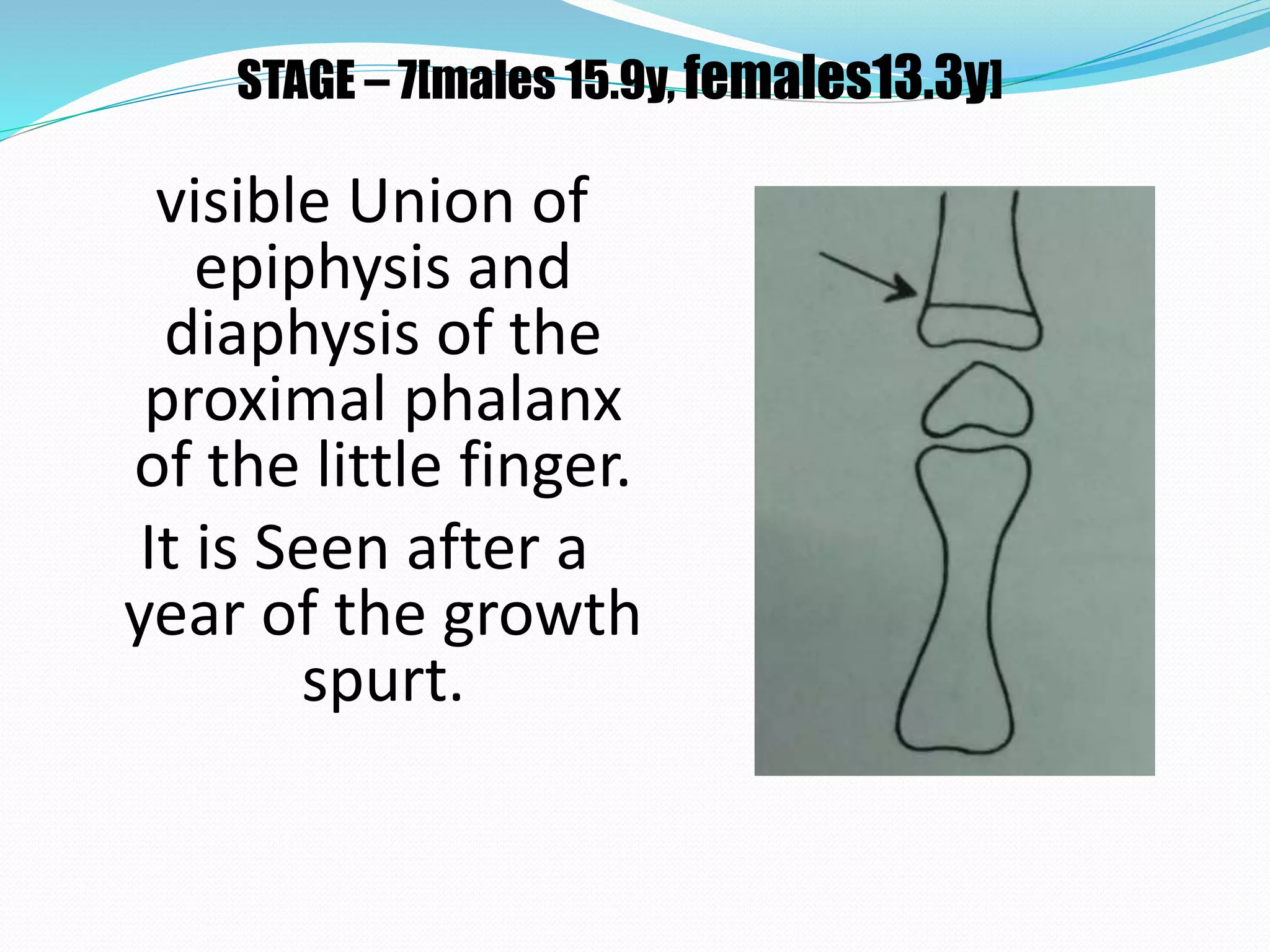 Skeletal maturity index | PPTX
