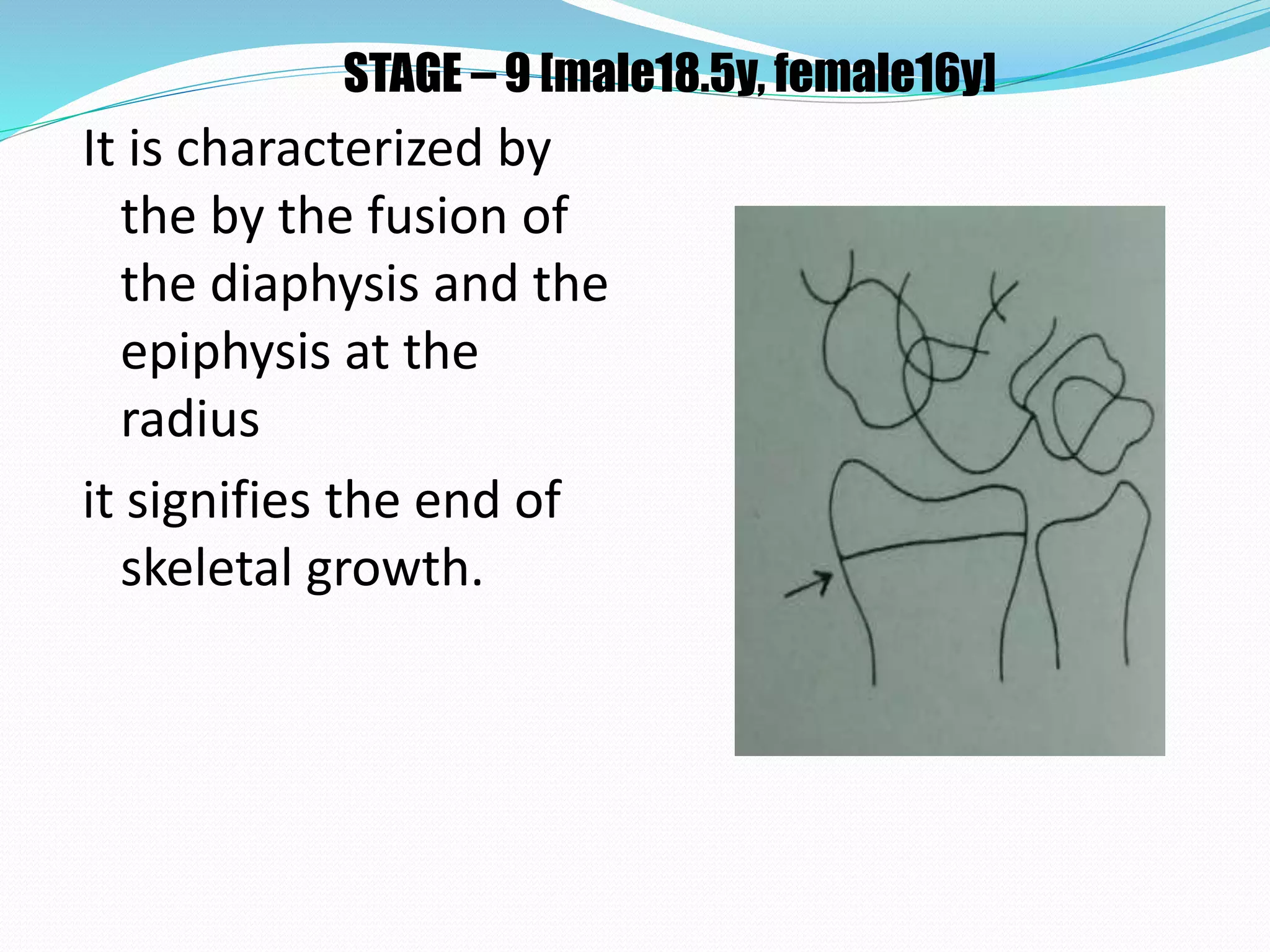 Skeletal maturity index | PPTX