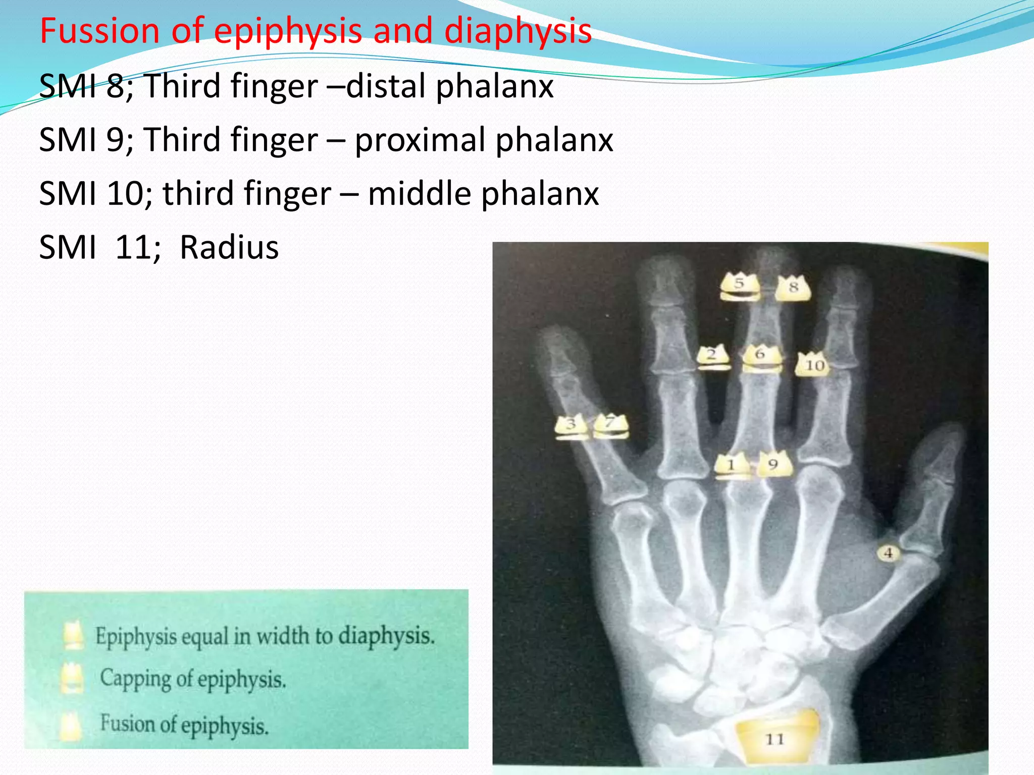 Skeletal Maturity Index Pptx