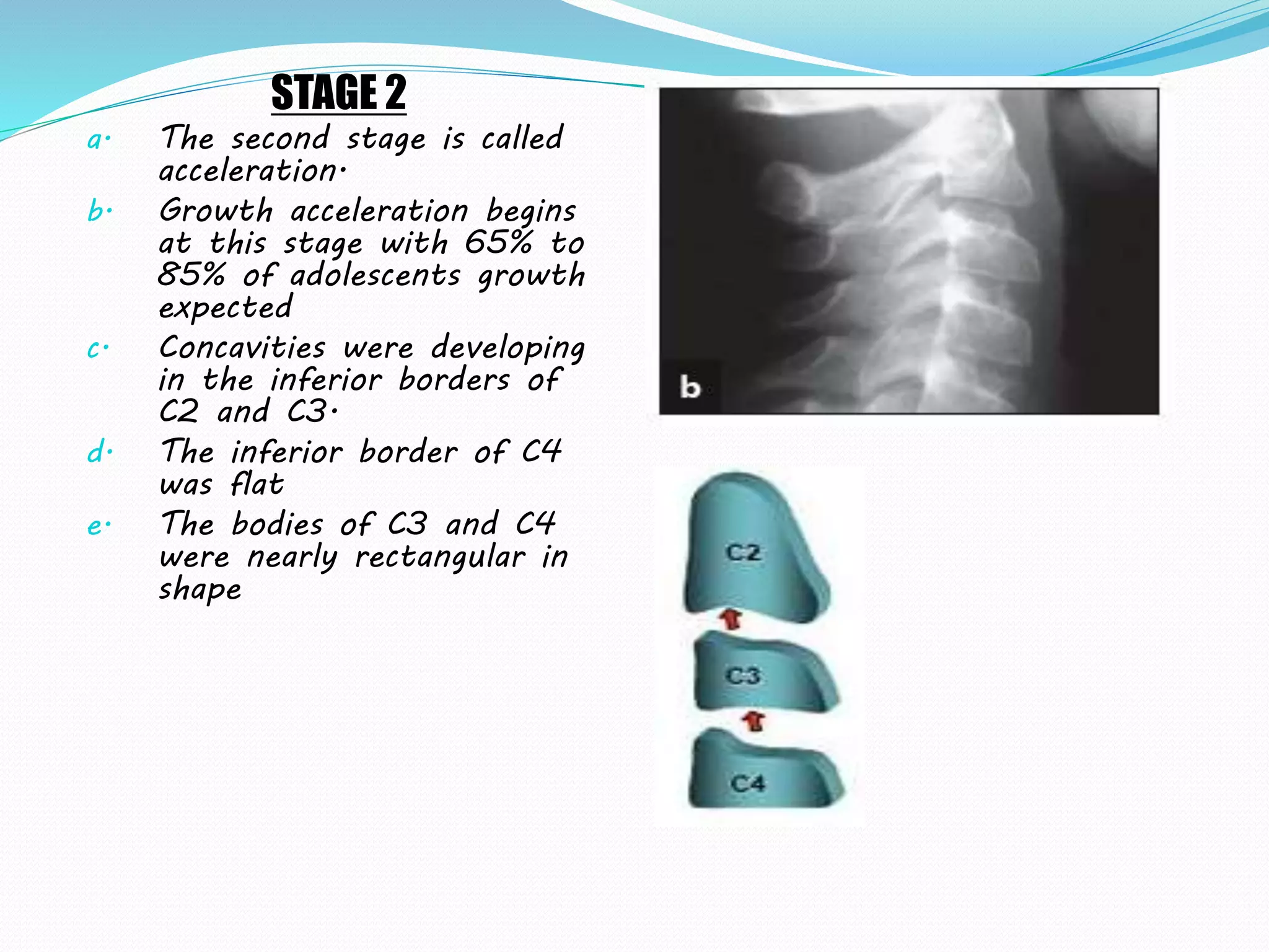 Skeletal maturity index | PPTX