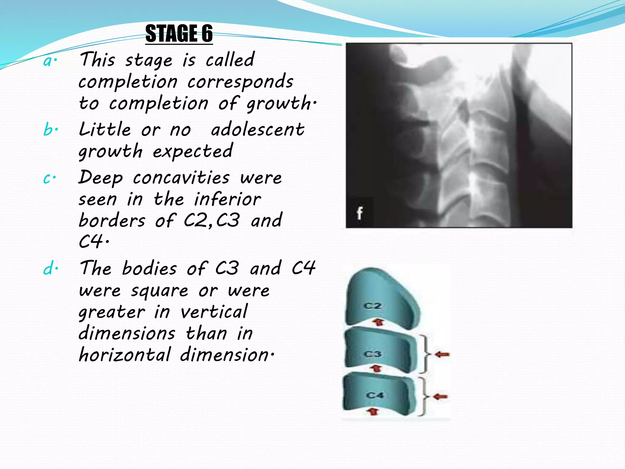 Skeletal maturity index | PPTX