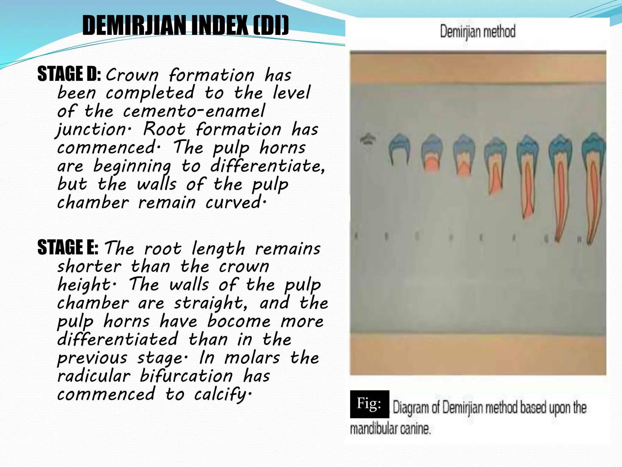Skeletal Maturity Index Pptx