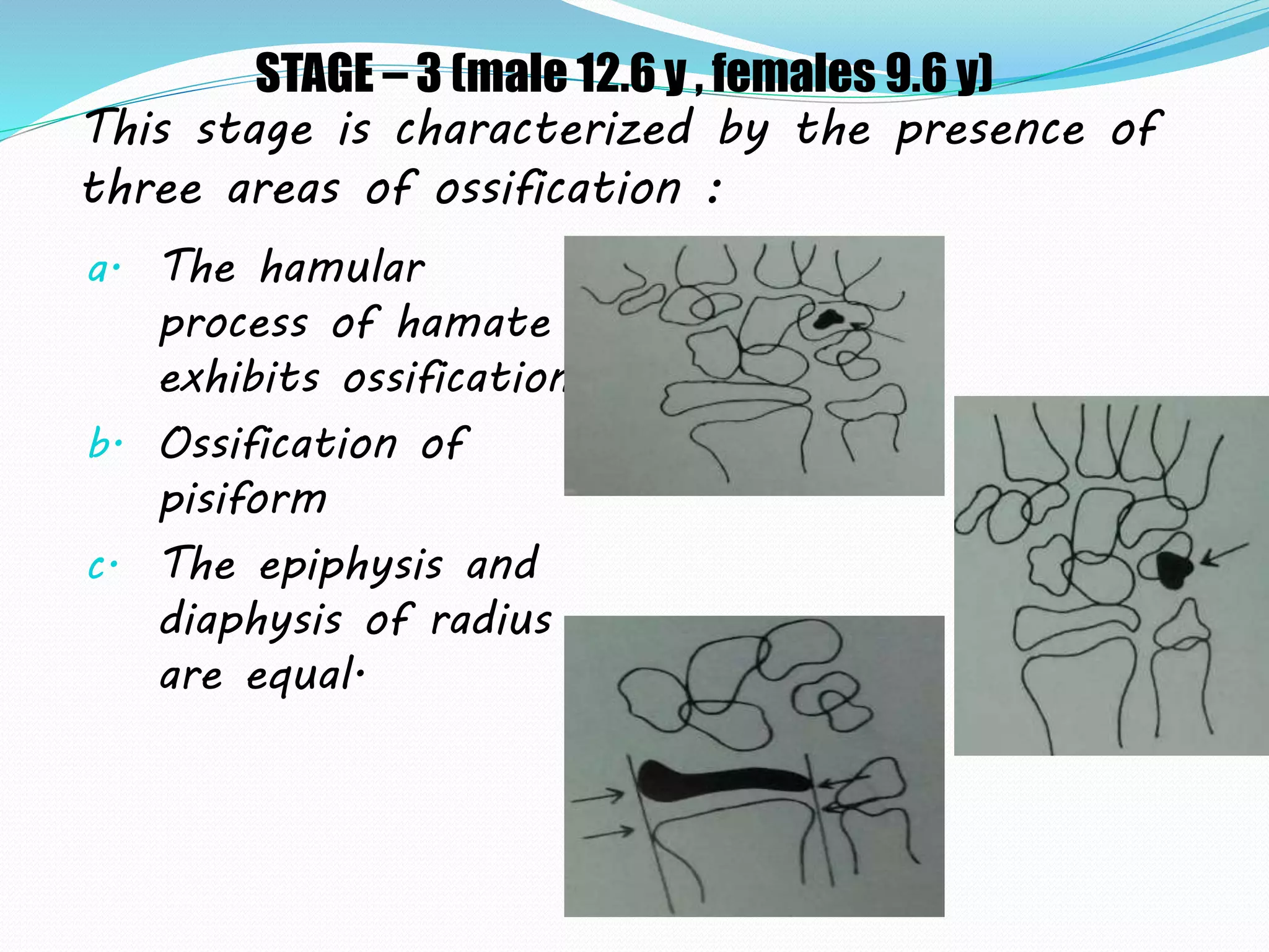 Skeletal maturity index | PPTX