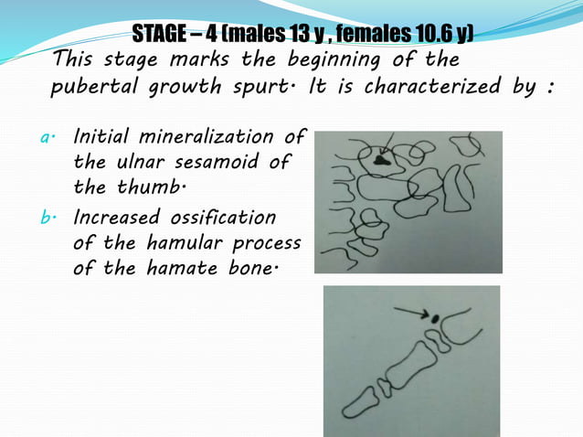 Skeletal maturity index | PPTX | Menopause | Endocrine and Metabolic ...