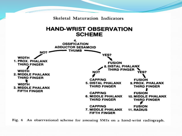 Skeletal Maturity Index Pptx