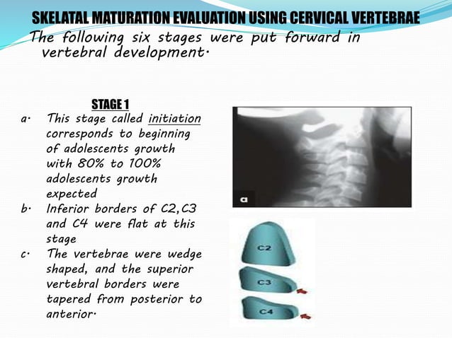Skeletal maturity index | PPTX | Menopause | Endocrine and Metabolic ...