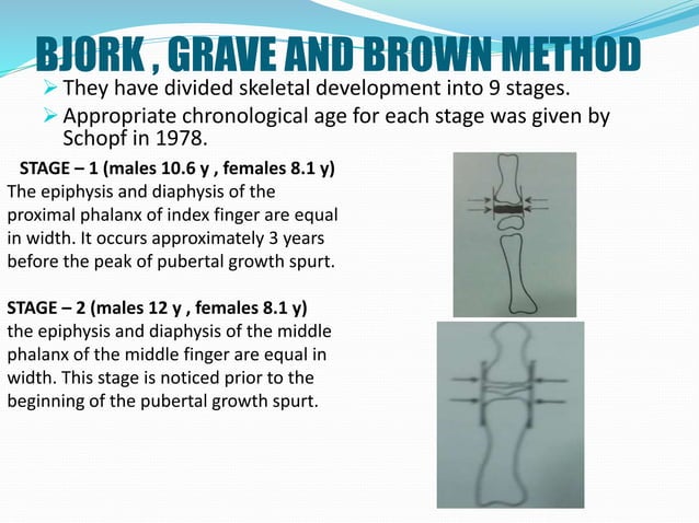 Skeletal maturity index | PPTX | Menopause | Endocrine and Metabolic ...