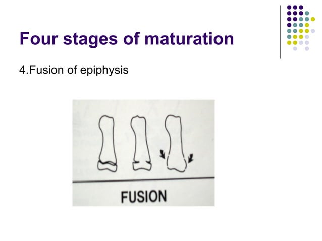 presentation on skeletal maturity indicator.ppt