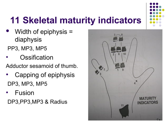 presentation on skeletal maturity indicator.ppt