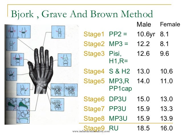 Skeletal maturity indicator