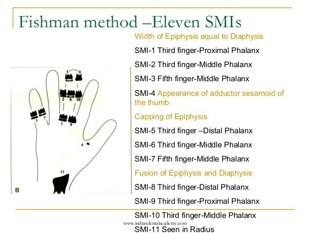 Skeletal maturity indicator (2)
