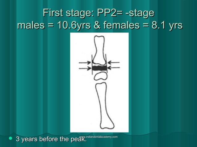 Skeletal maturity indicators/endodontic courses | PPT | Bone and Joint ...
