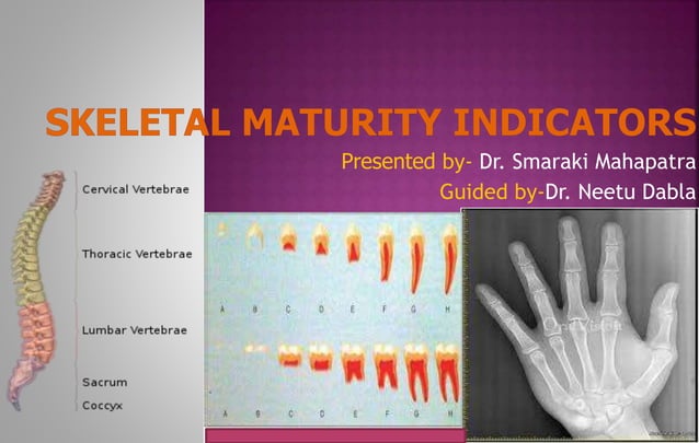 Skeletal maturity indicators.pptx modified | PPT