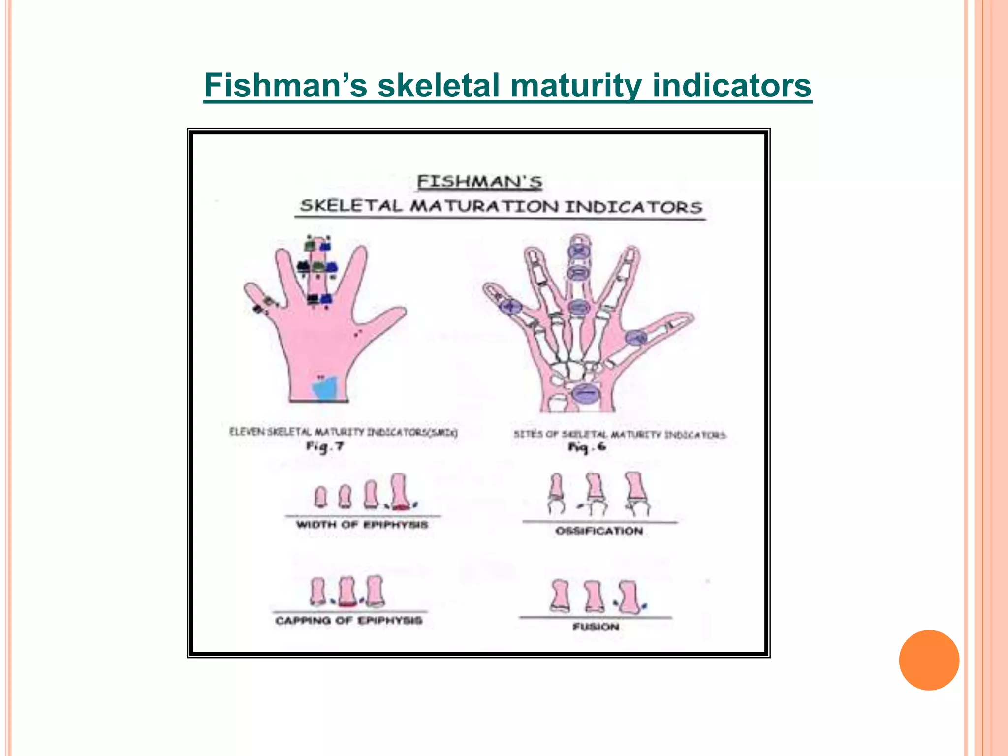 Skeletal maturity indicators | PPTX