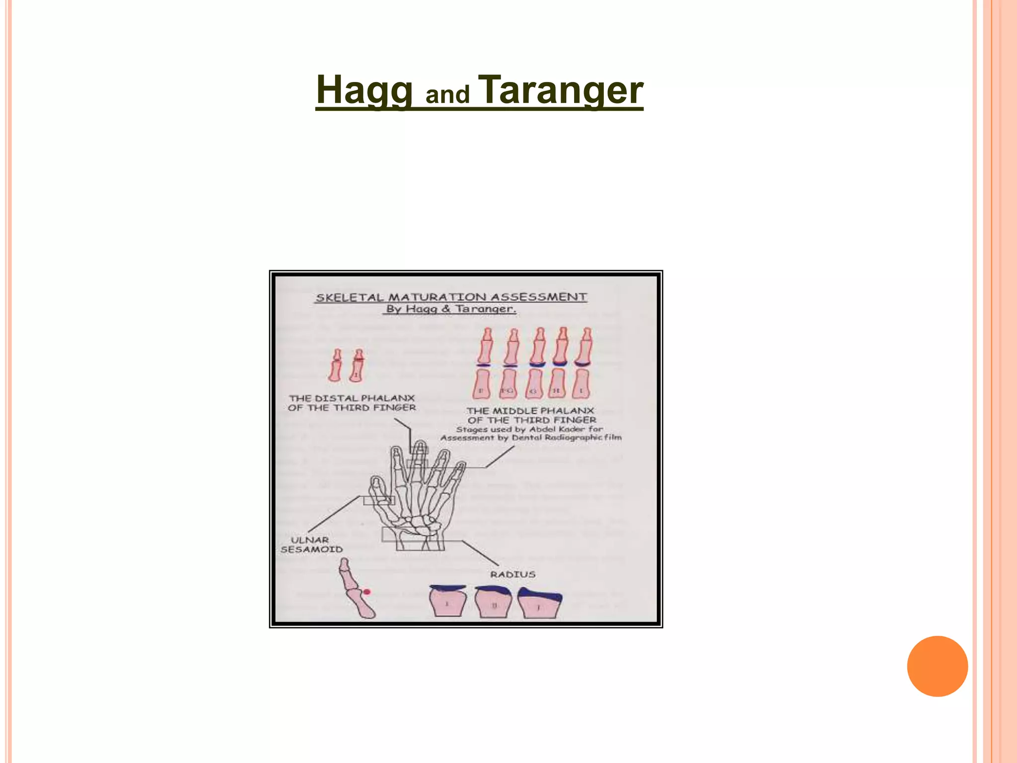 Skeletal maturity indicators | PPTX