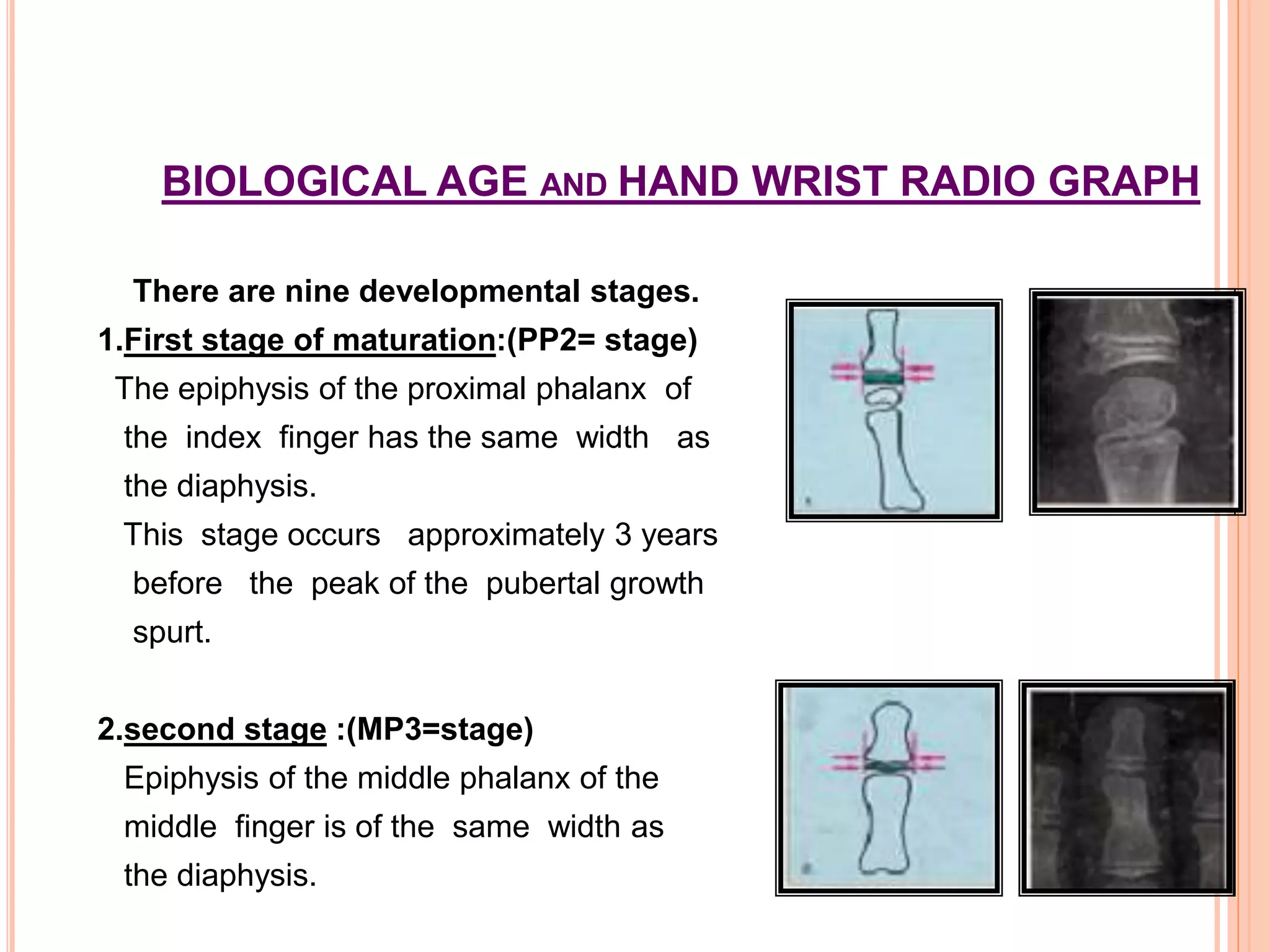 Skeletal maturity indicators | PPTX