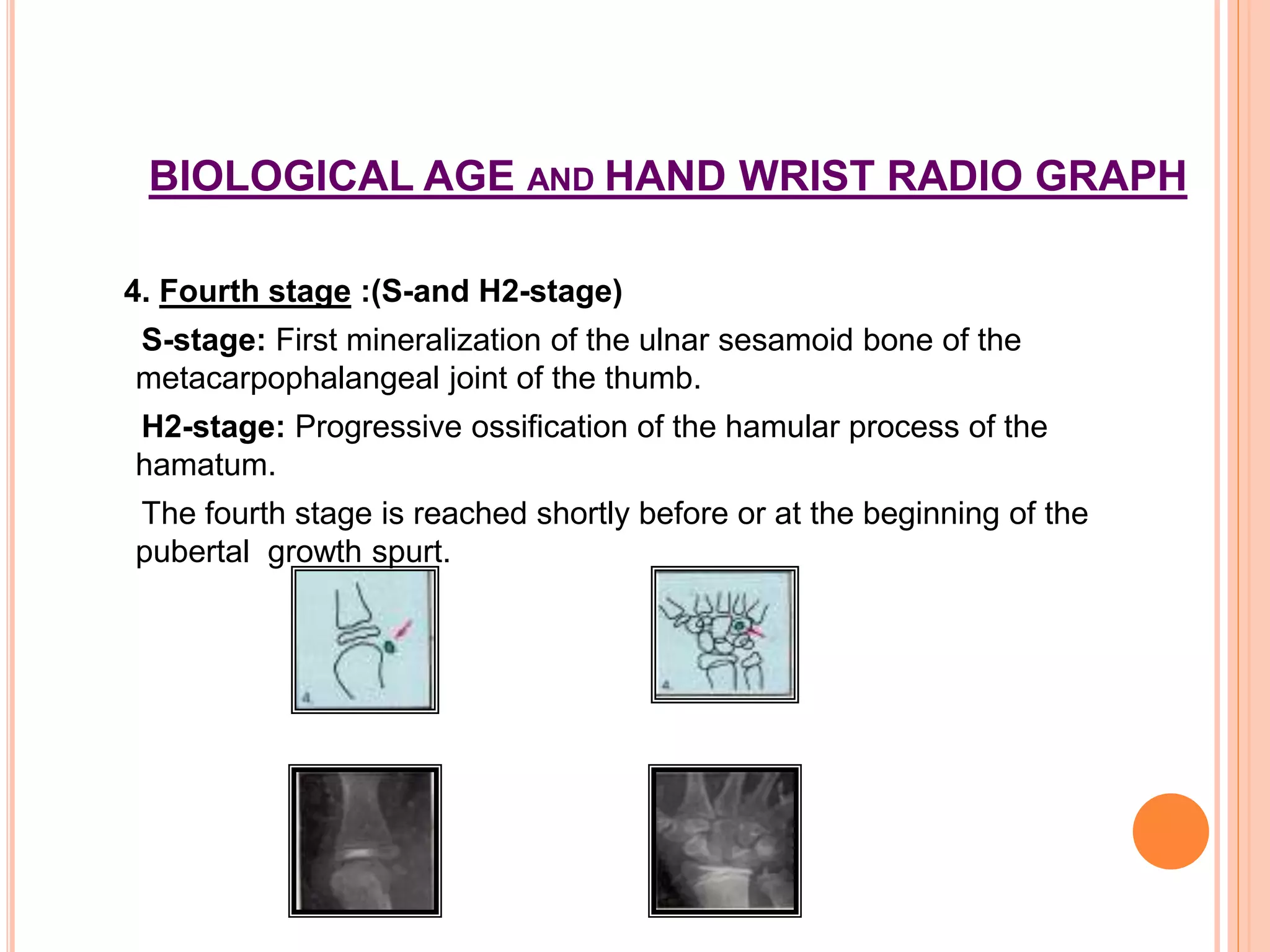 Skeletal maturity indicators | PPTX