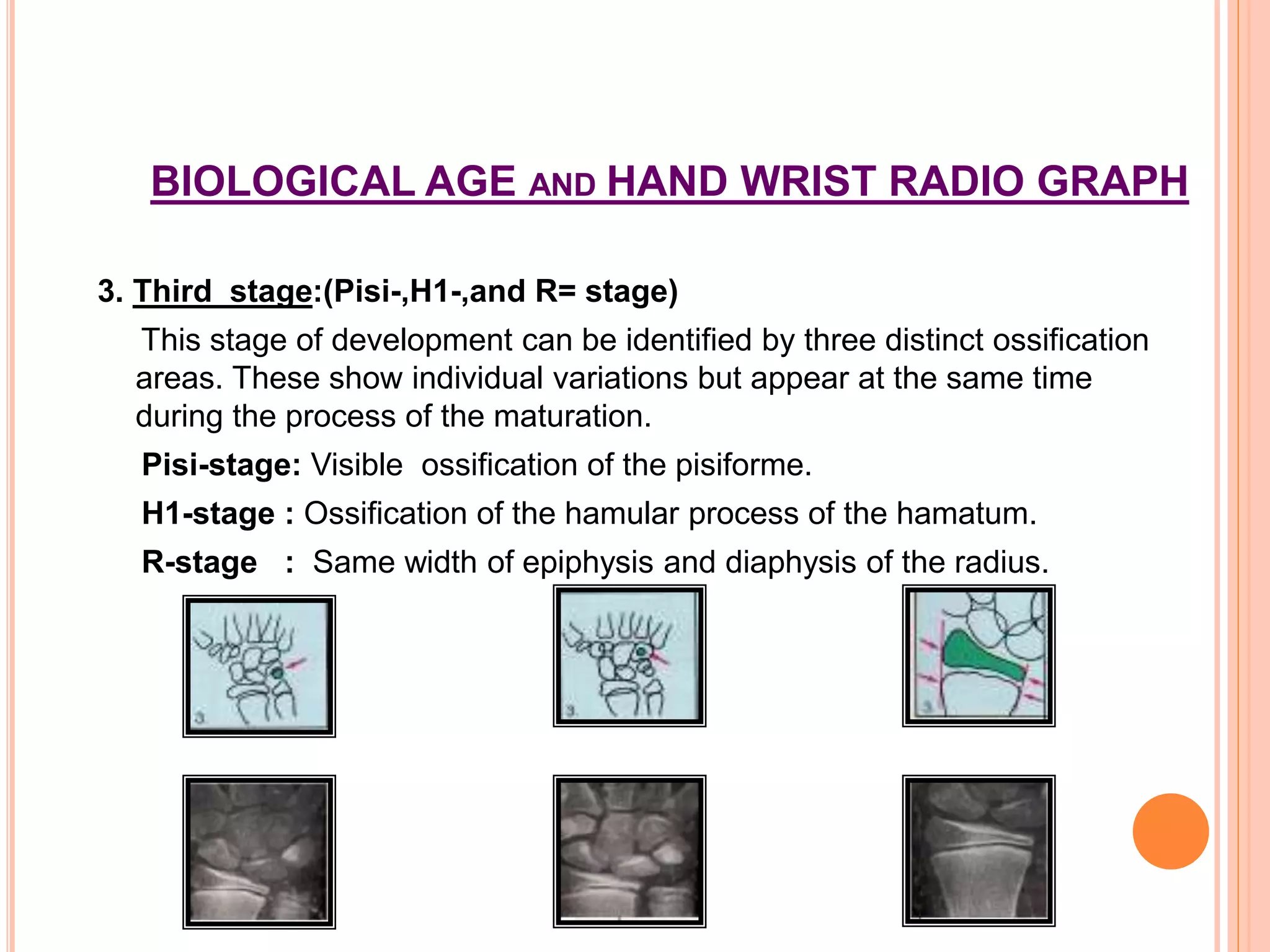 Skeletal maturity indicators | PPTX