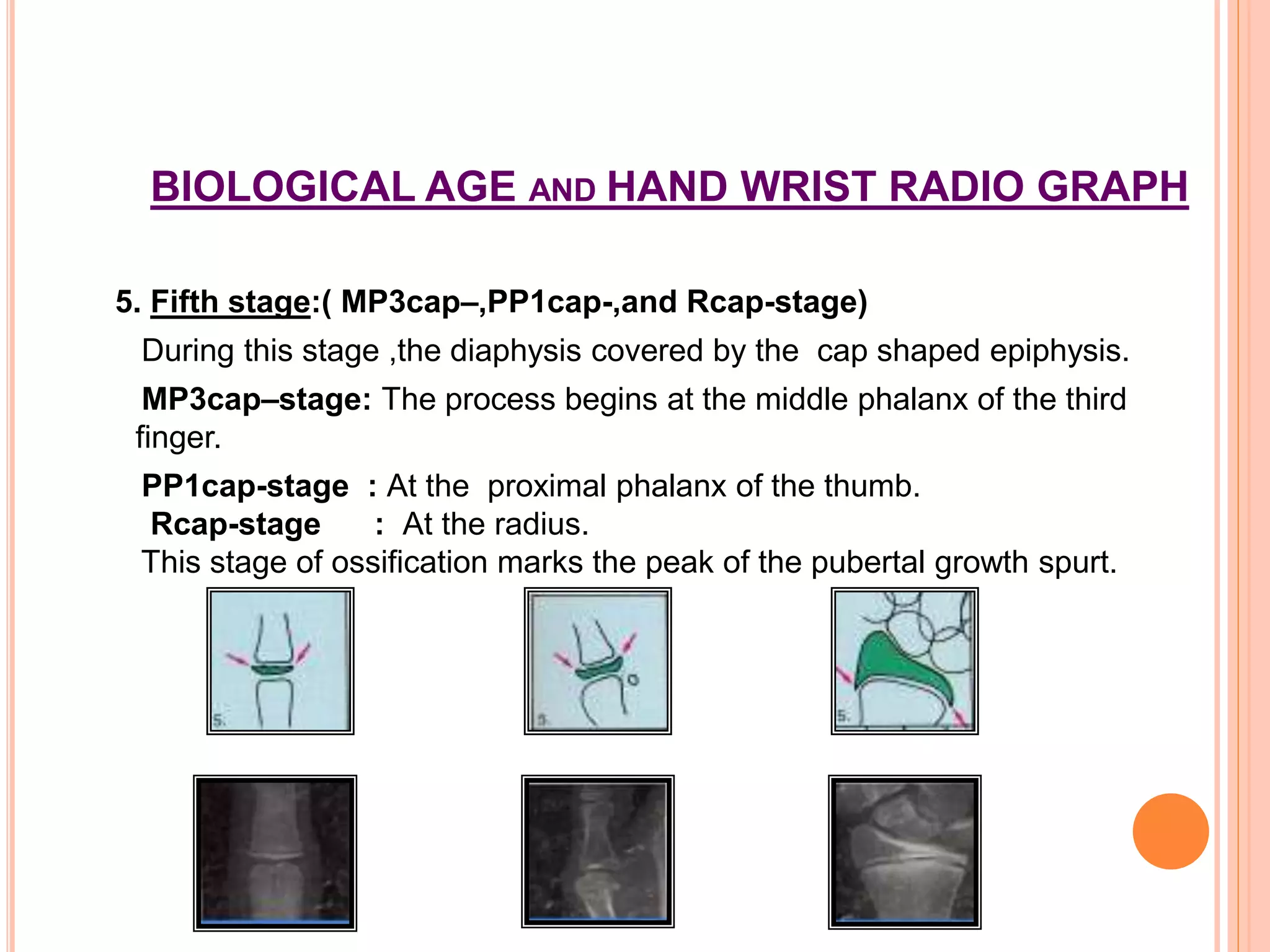 Skeletal maturity indicators | PPTX