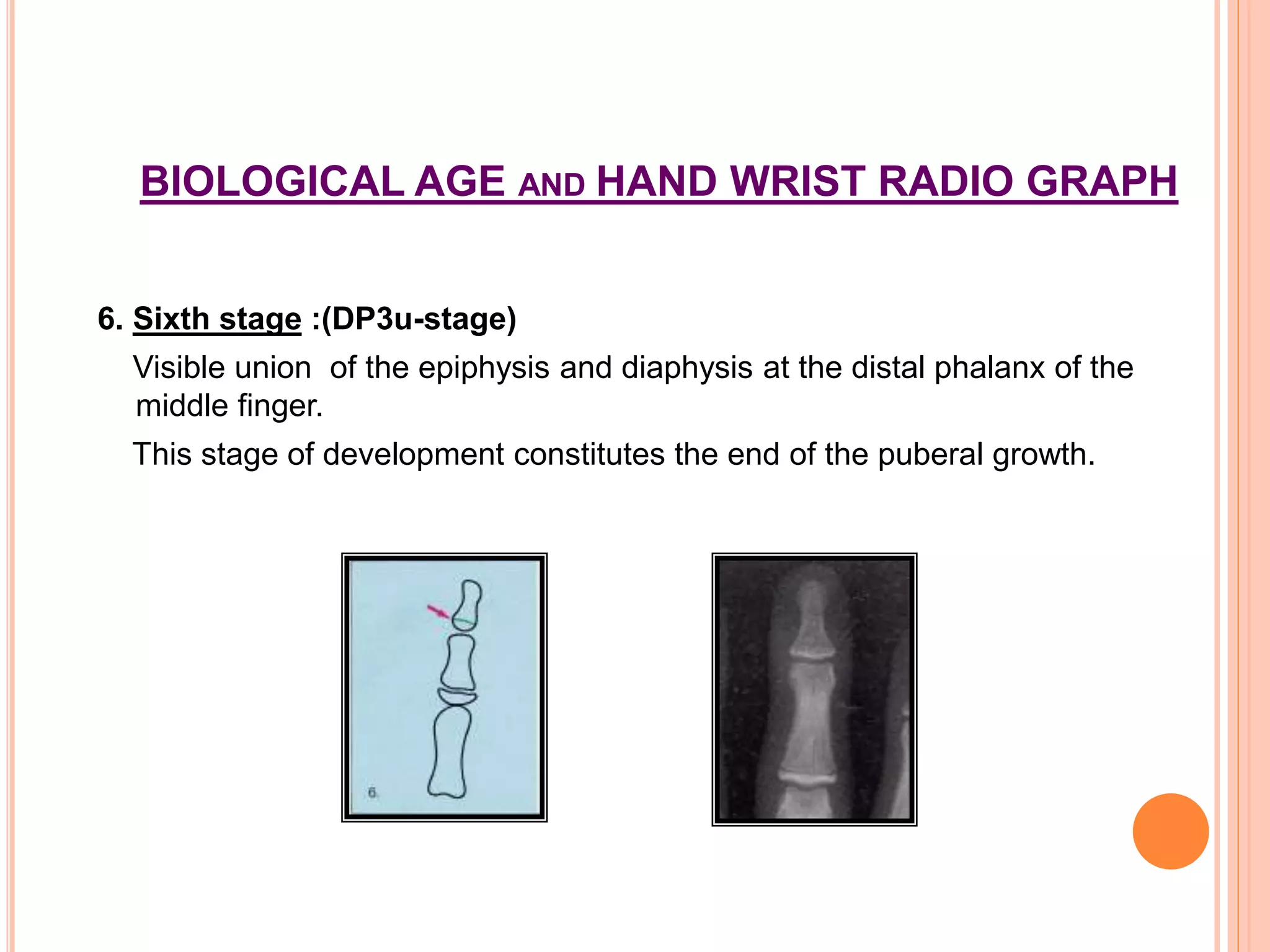 Skeletal maturity indicators | PPTX