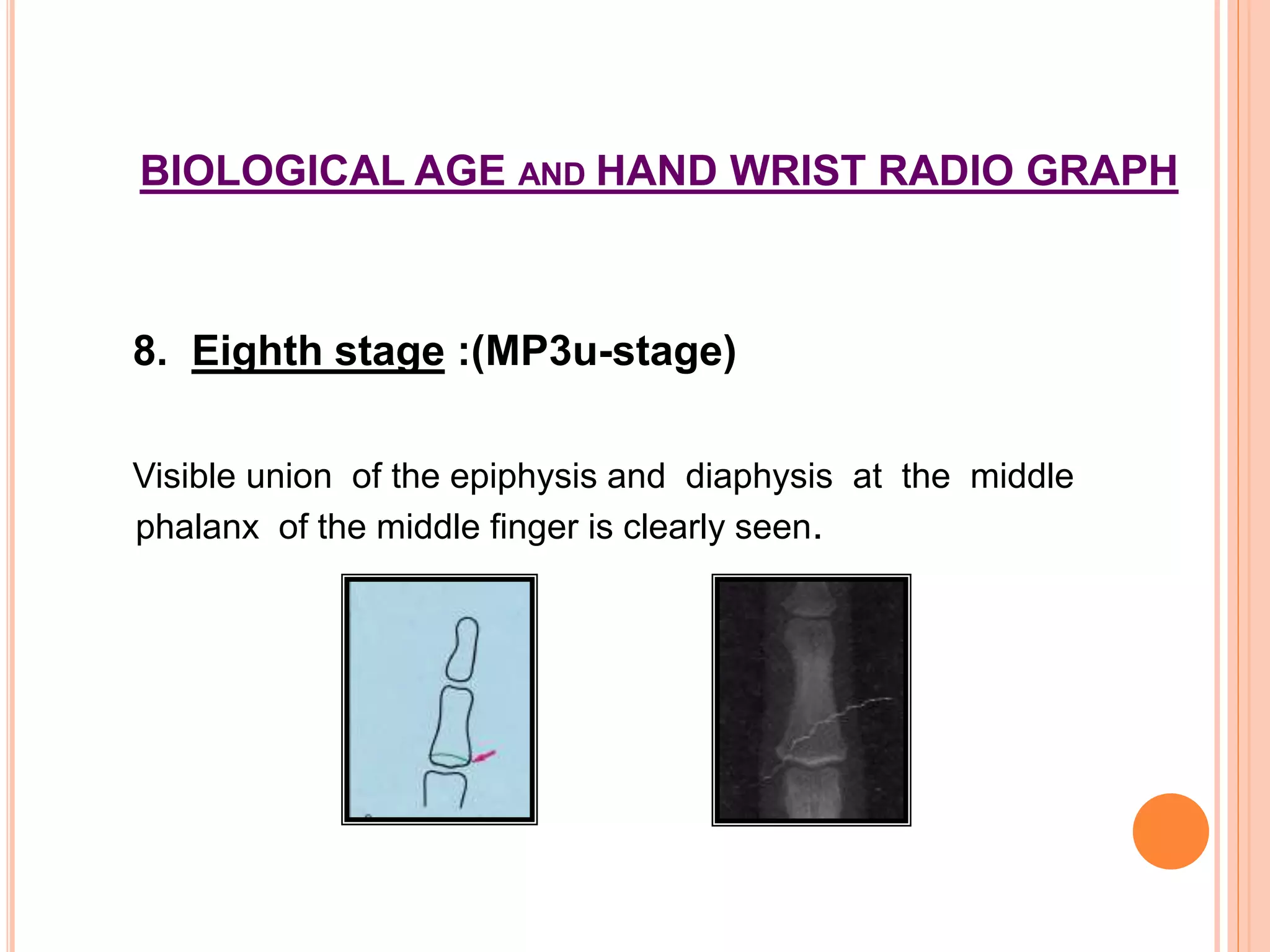 Skeletal maturity indicators | PPTX