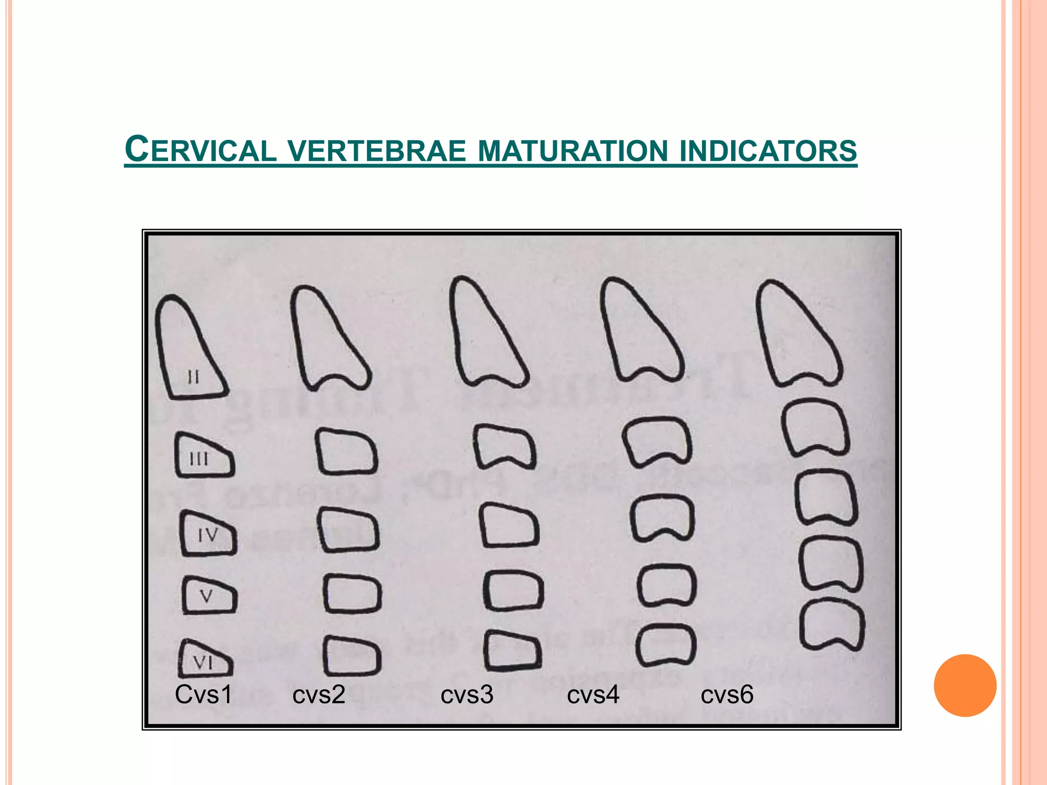 Skeletal maturity indicators | PPTX