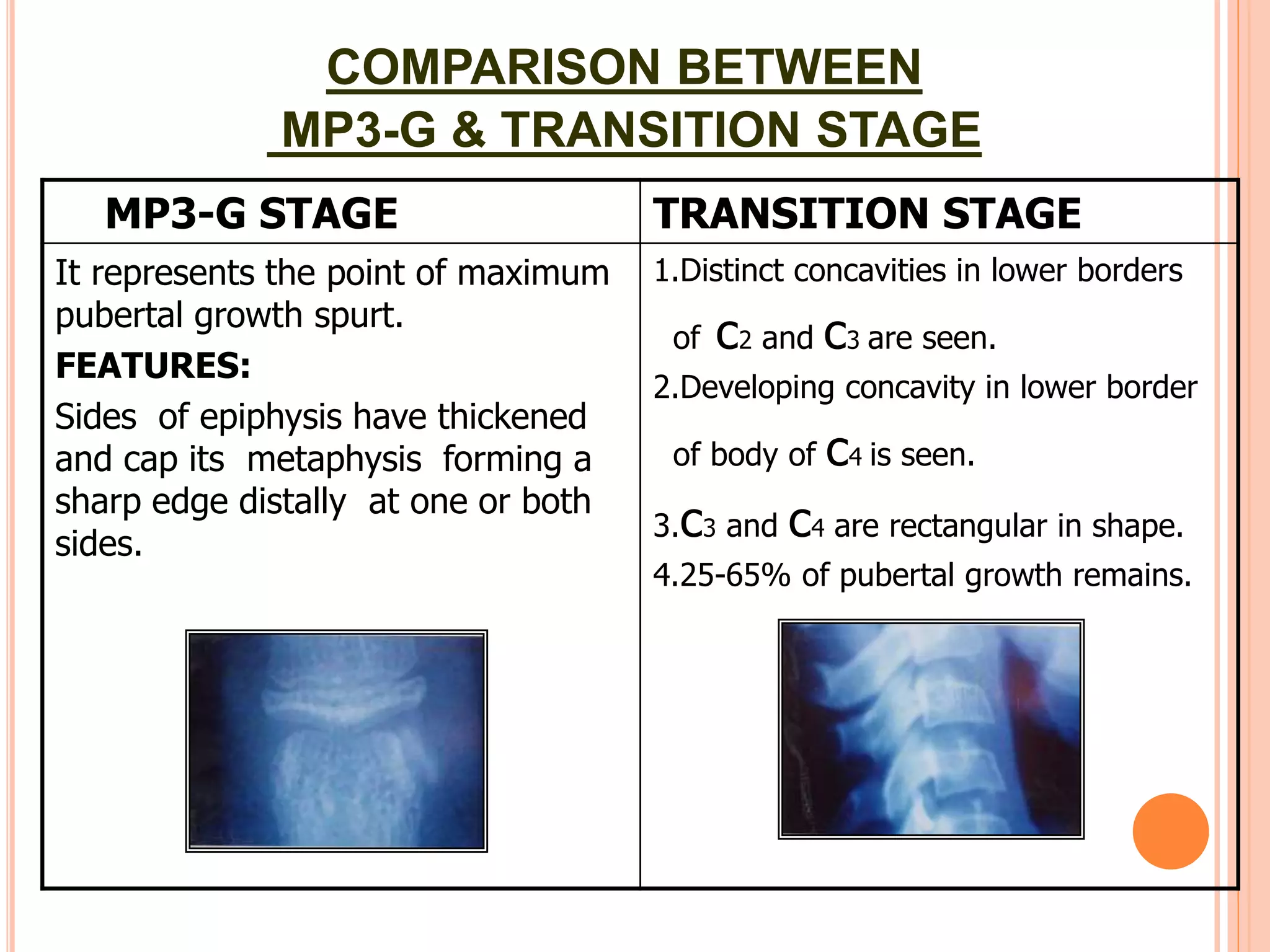 Skeletal maturity indicators | PPTX