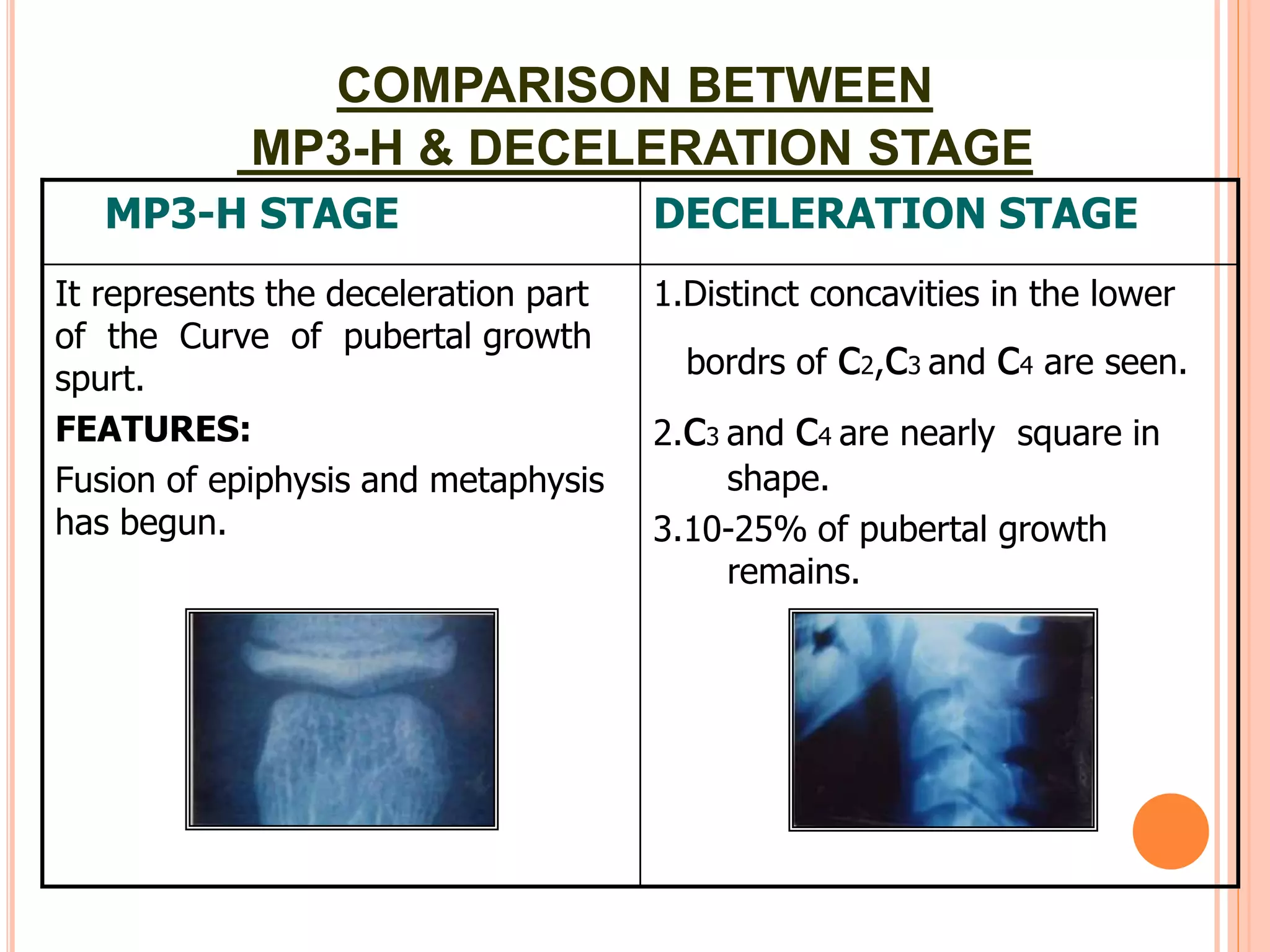 Skeletal maturity indicators | PPTX
