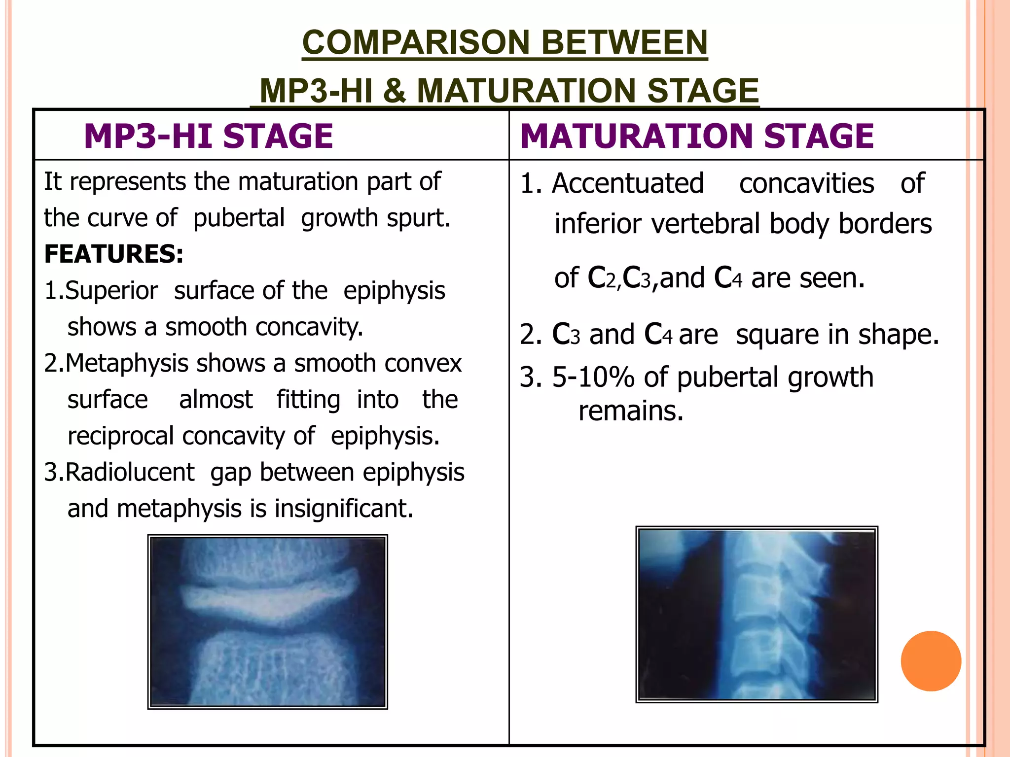 Skeletal maturity indicators | PPTX