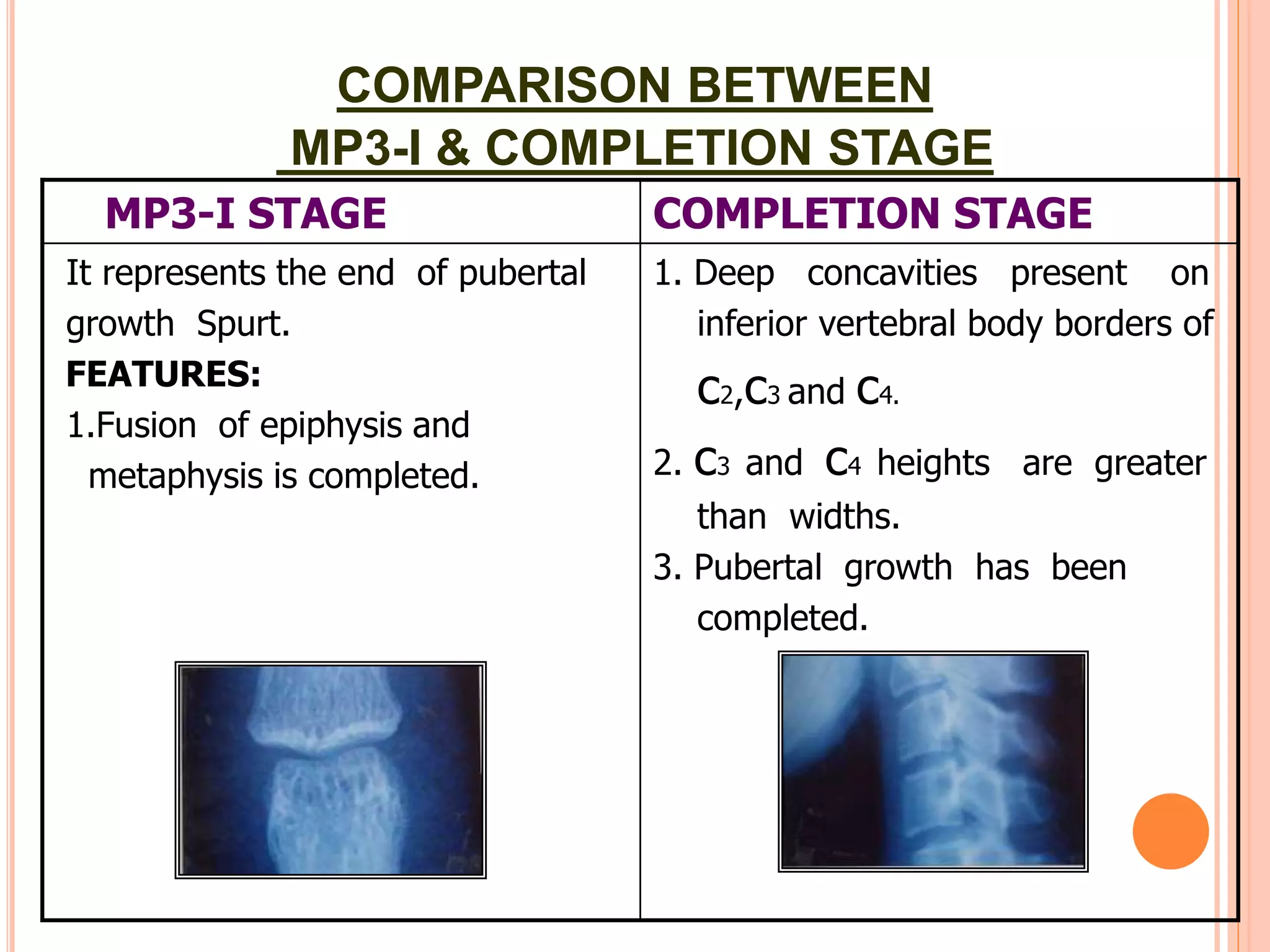 Skeletal maturity indicators | PPTX