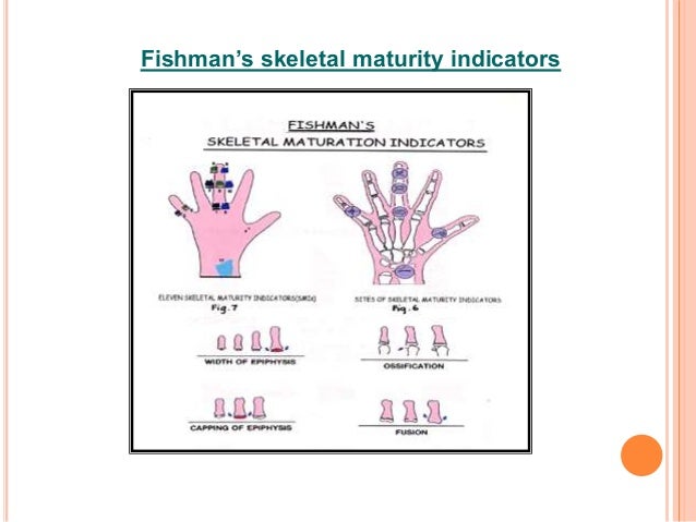 Skeletal maturity indicators