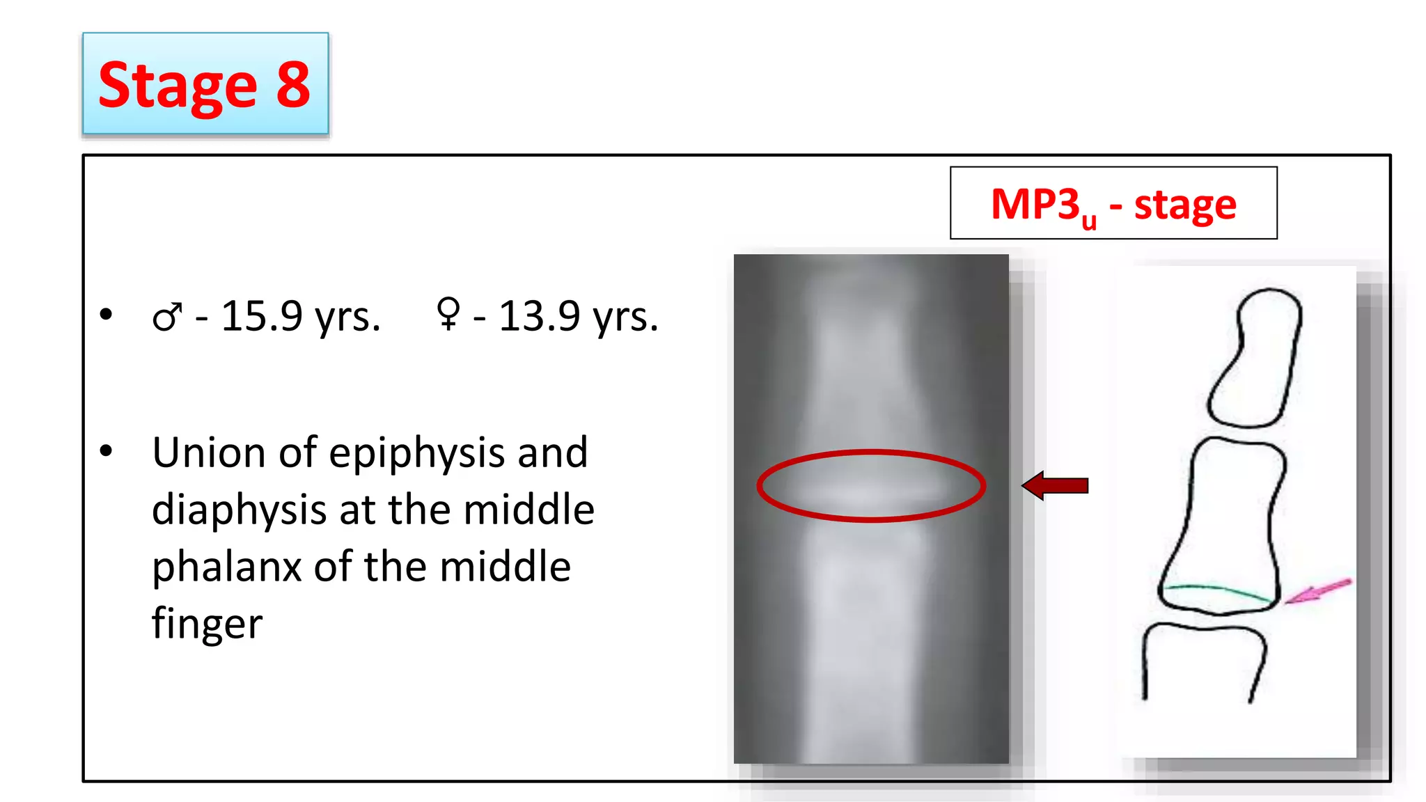 Skeletal Maturity Indicator Short Pptx