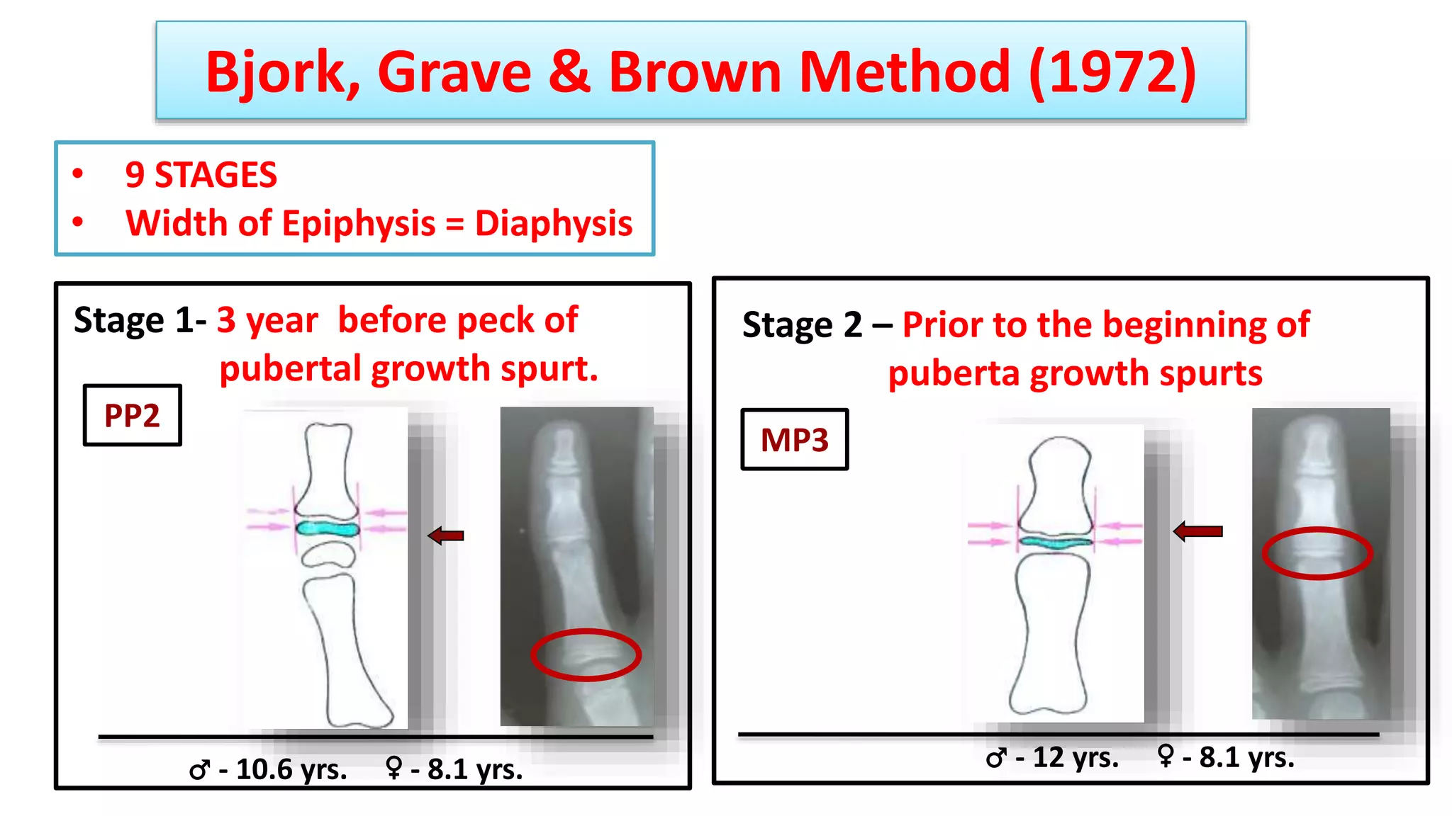 Skeletal Maturity Indicator Short Pptx