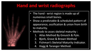 Skeletal maturity indicator short | PPTX