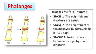 Skeletal maturity indicator short | PPTX