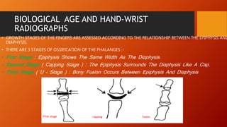 Skeletal maturity indicators | PPTX