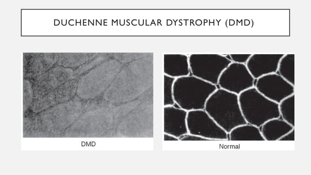 skeletal muscle development of fetus embryonic growth | PPTX