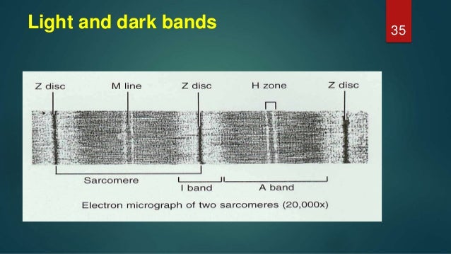 Skeletal muscle must watch