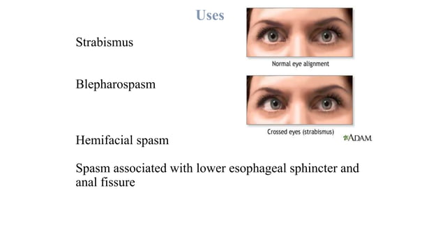 Skeletal muscle relaxants & Spasmolytics dr abdul azeem | PPTX