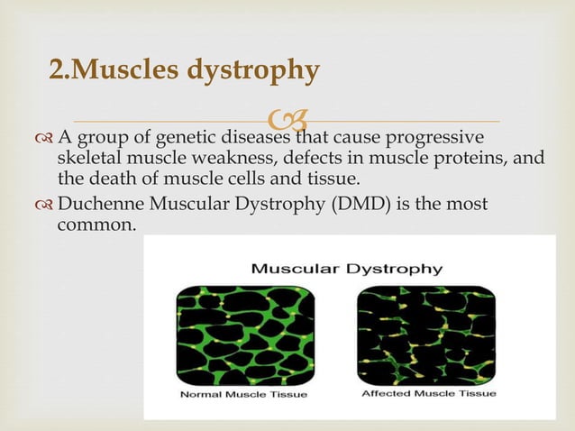 Skeletal muscles disease and disorder | PPTX