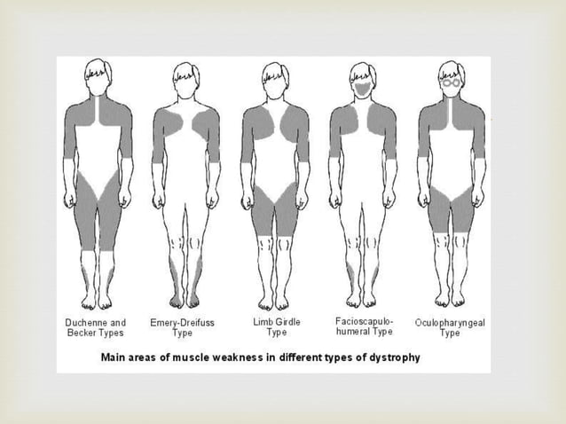 Skeletal muscles disease and disorder | PPTX