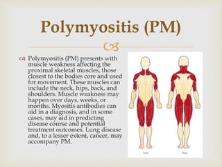 Skeletal muscles disease and disorder | PPTX