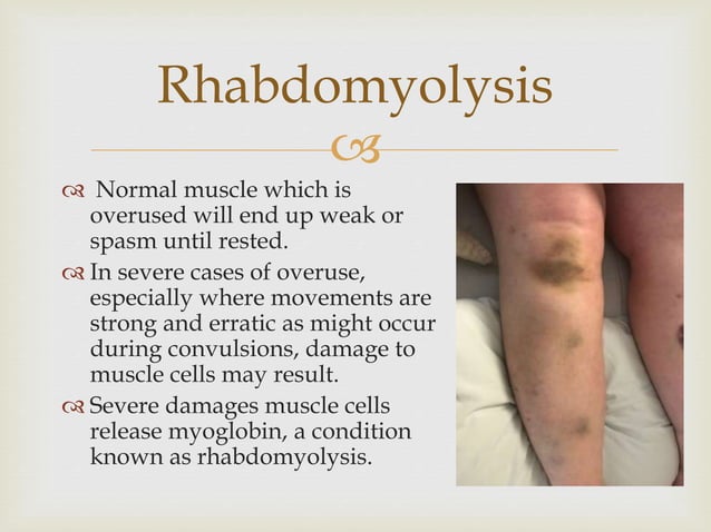Skeletal muscles disease and disorder | PPTX