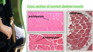 Skeletal muscles diseases | PPTX