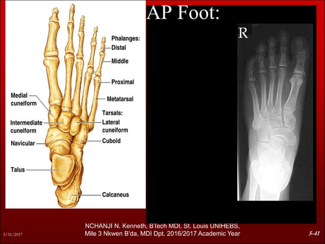 Comprehensive Skeletal Radiographic Anatomy, MDIRT, Nchanji Nkeh Keneth ...