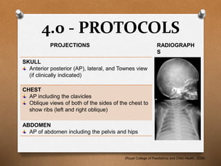 Skeletal survey on pediatric patient | PPTX